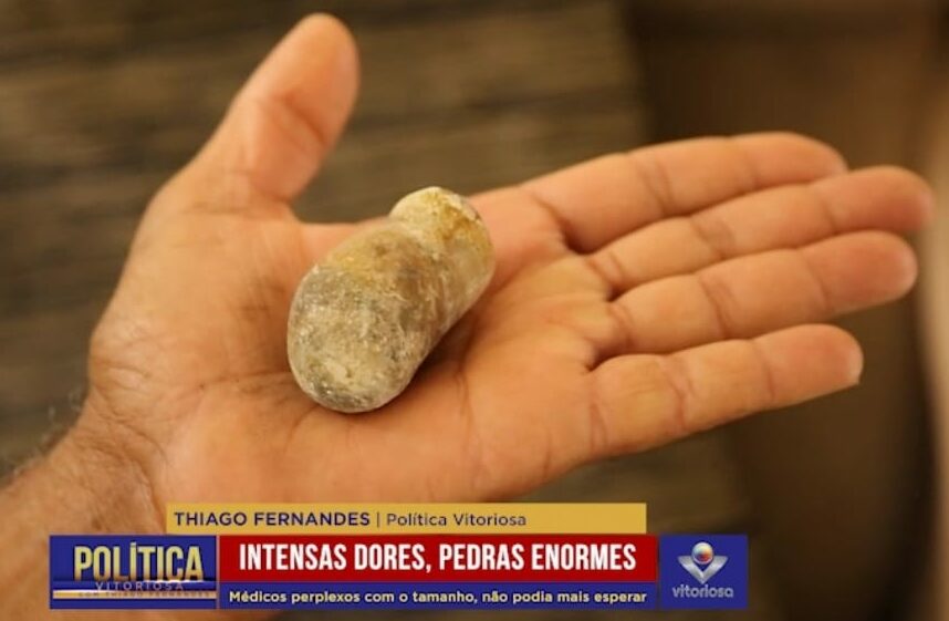 ABSURDO: ABSURDO: